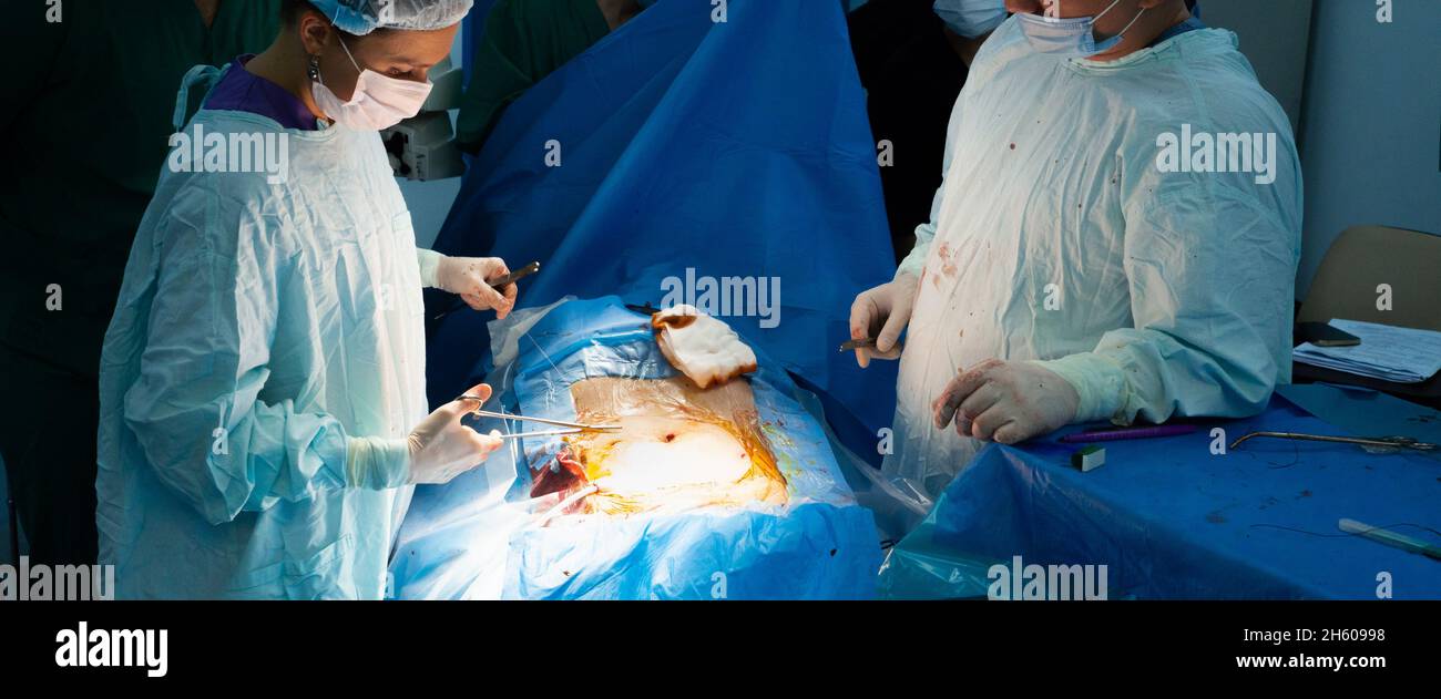 The team of surgeons sutures the patient's skin at the end of the ...