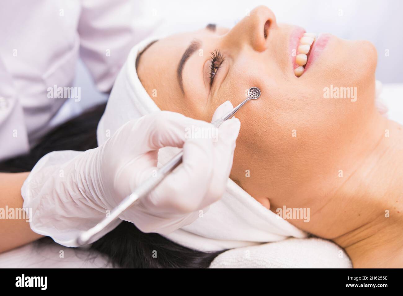 Comedones hi-res stock photography and images - Alamy