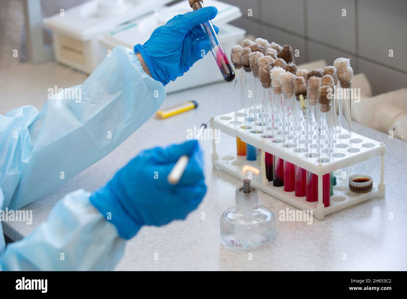 The hands of a physician laboratory assistant in an infectious disease ...