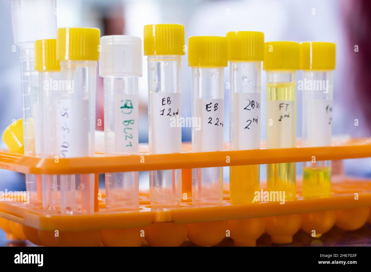A set of closed test tubes with chemical reagents stand in a tripod in ...