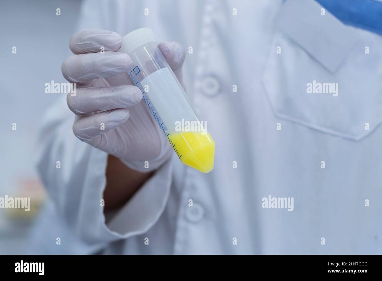 Yellow fluorescent protein hi-res stock photography and images - Alamy