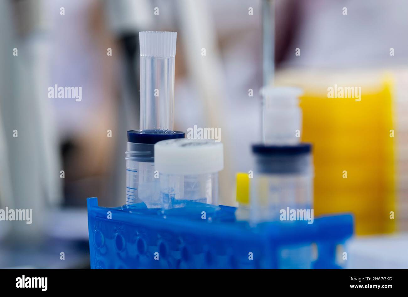 Test tubes and chemical plastic tubes are in a blue rack. Portable ...