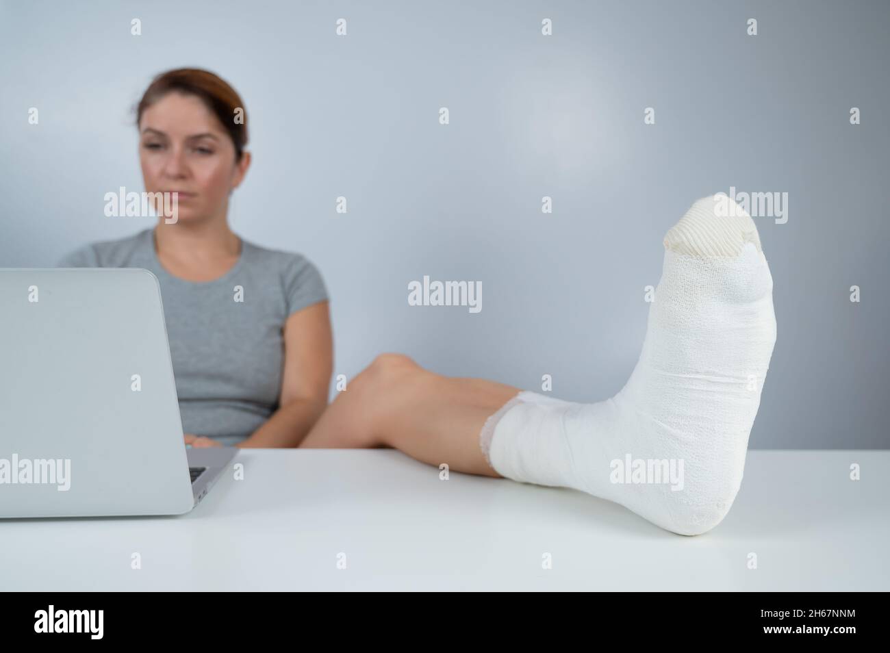 Woman plaster cast on leg hi-res stock photography and images - Alamy