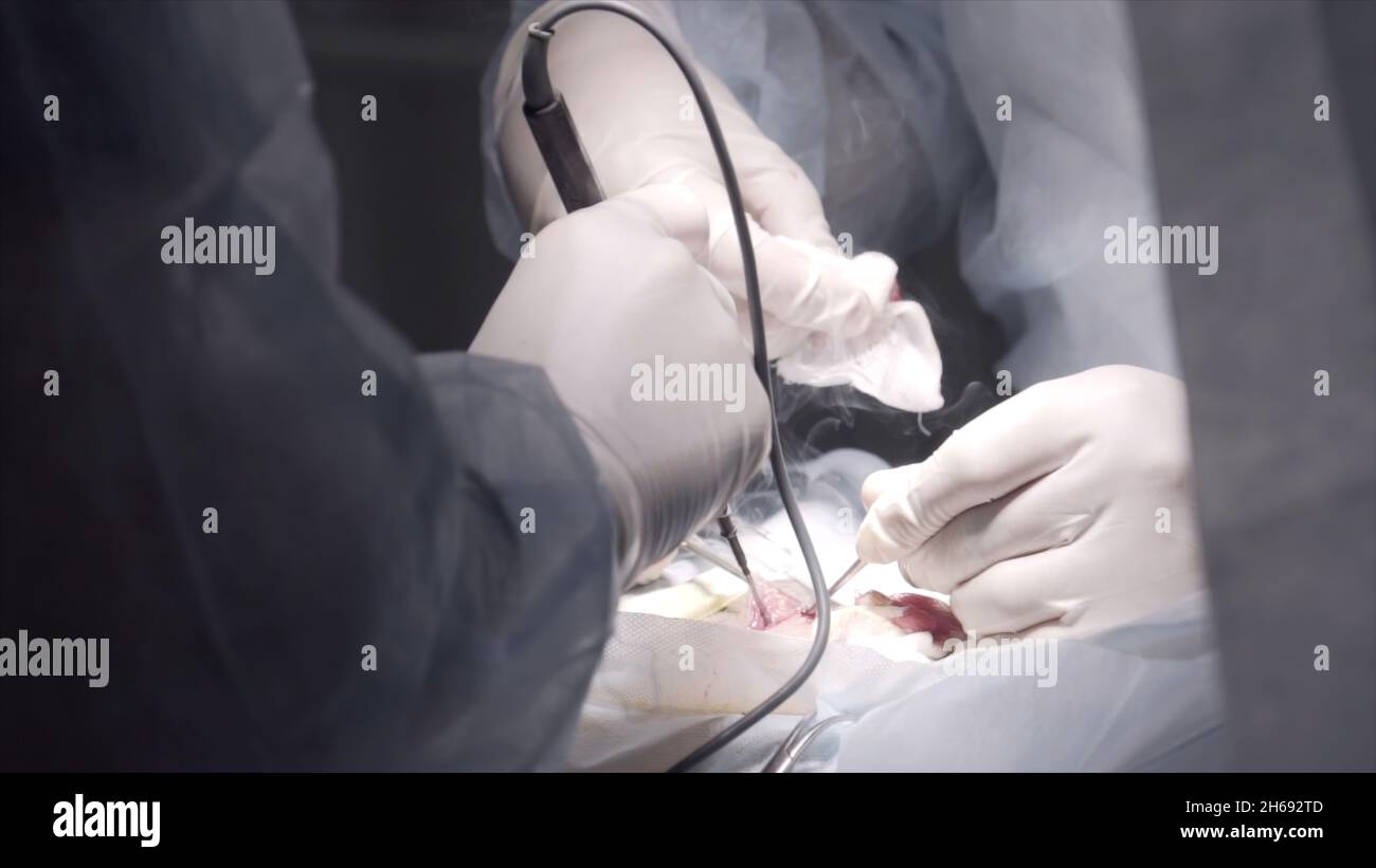 Close up of procedure is being carried out on a patient with ...