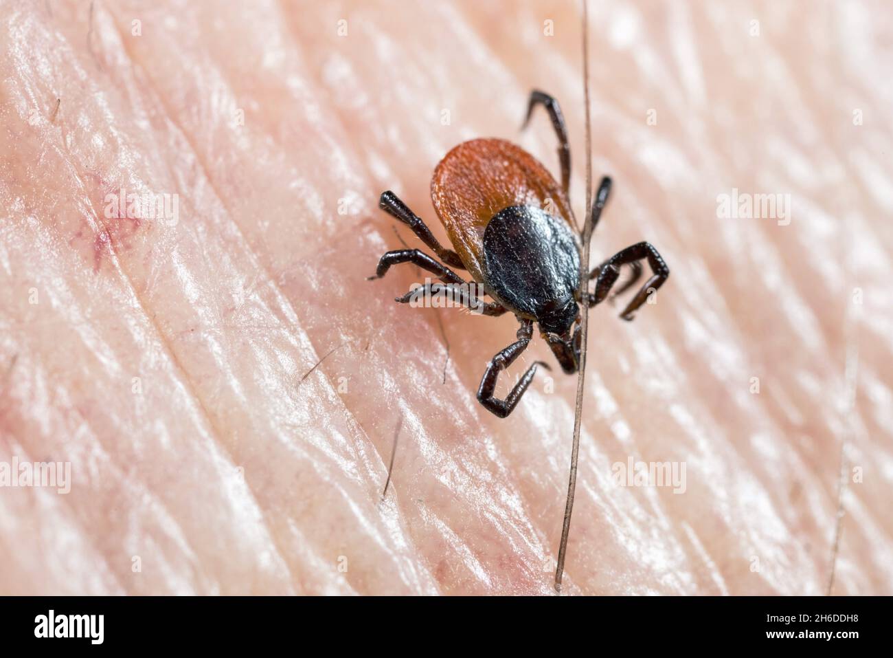 European castor bean tick, European sheep tick (Ixodes ricinus), sits ...
