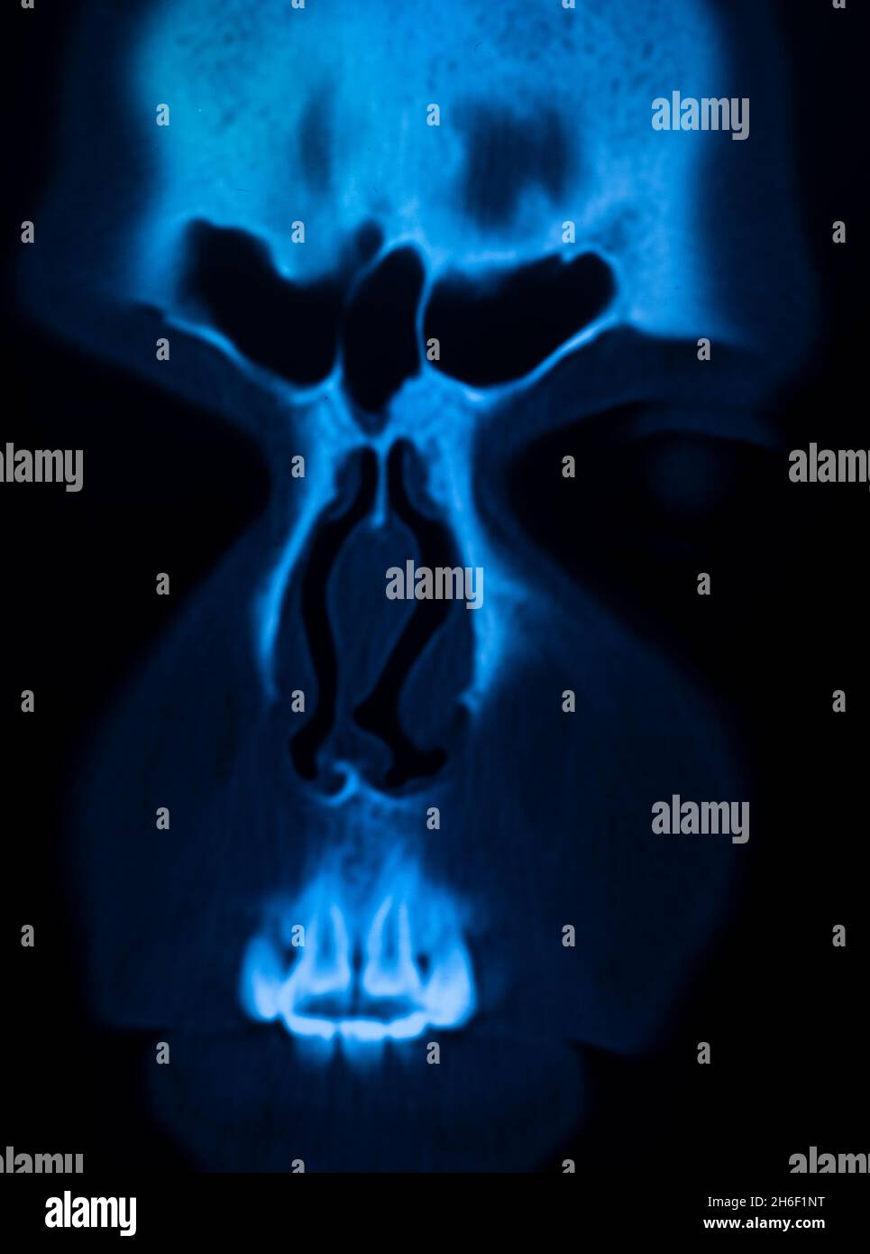Xray scan skull nose medical exam results from hospital clinic Stock ...