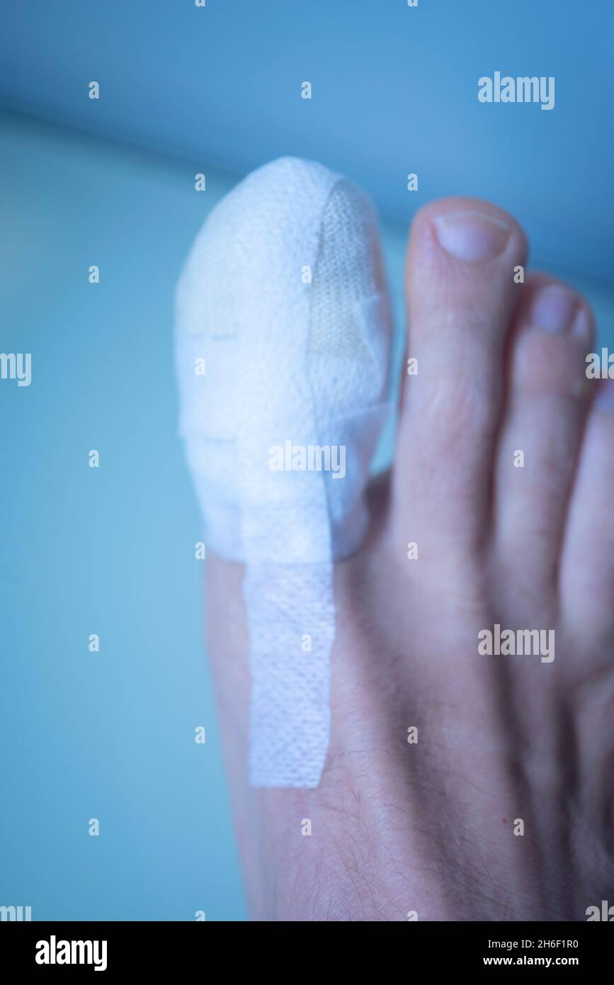 Foot big toe bandage injured feet in medical clinic hospital center ...