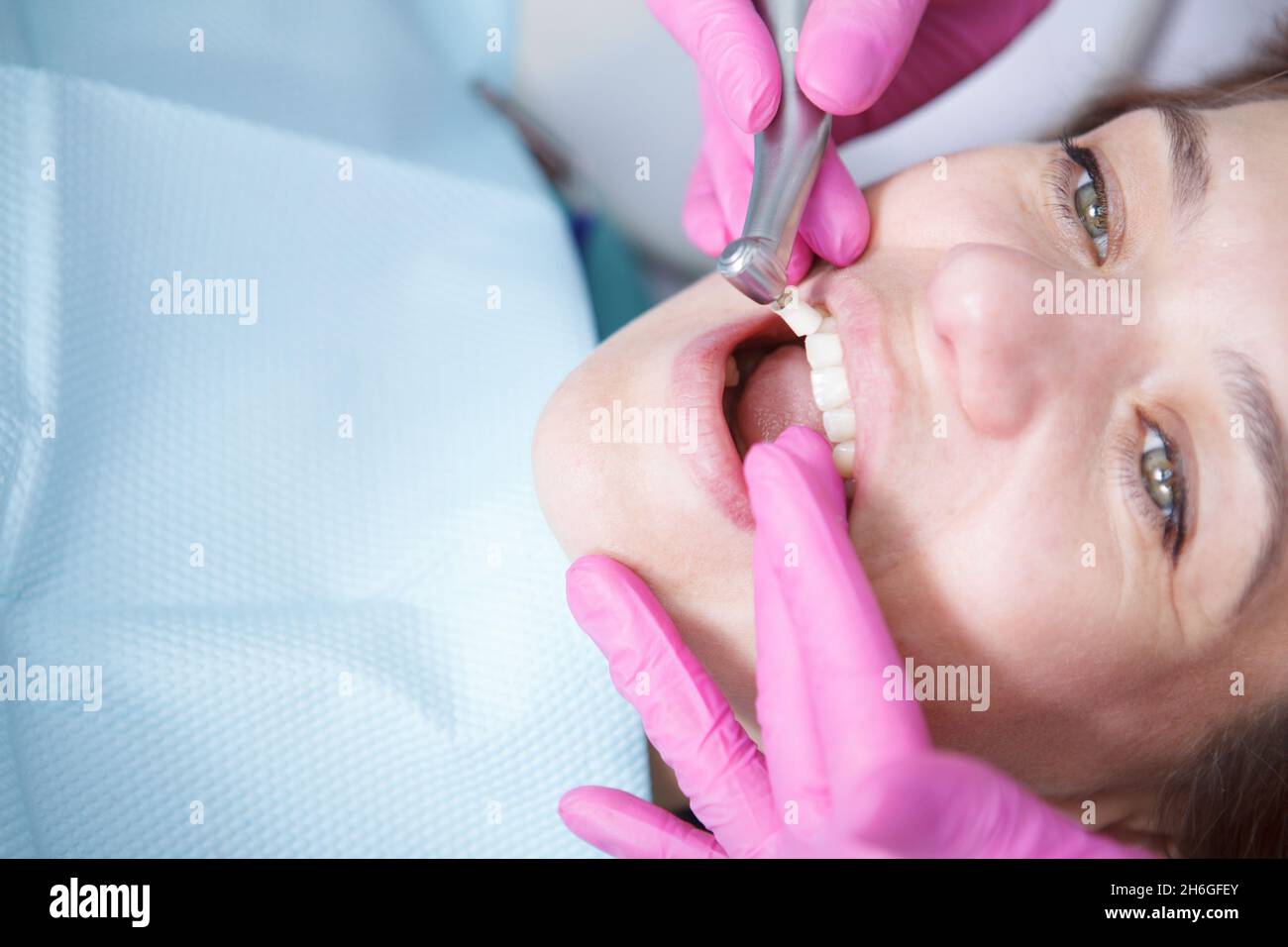 Women is having her teeth cleaned by dentist hi-res stock photography ...