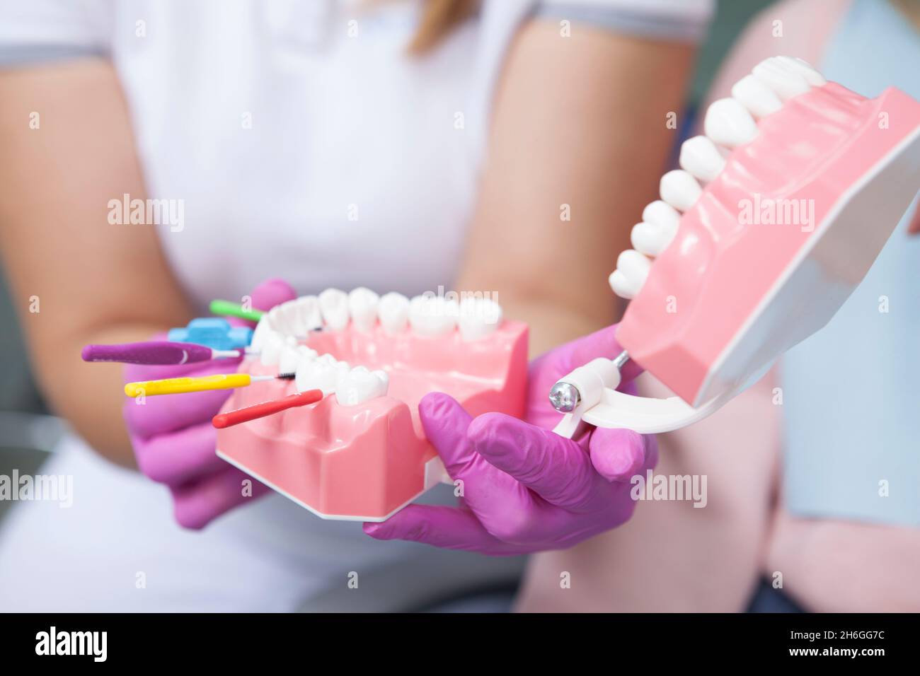 Close up of jaw model in hands of female dentist demonstrating using ...