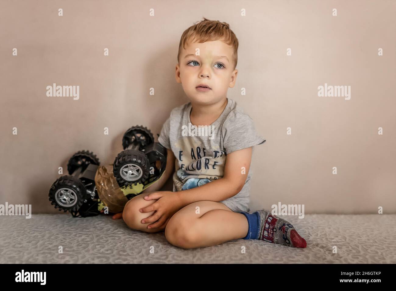 Child abuse bruise hi-res stock photography and images - Alamy