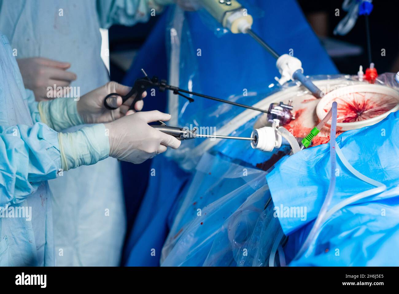 Laparoscopic operation hi-res stock photography and images - Alamy