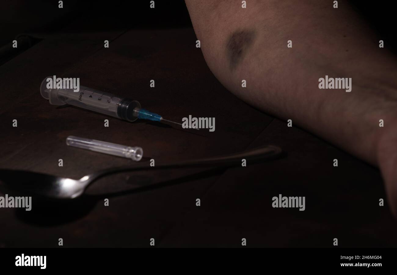 Dark skin bruise hi-res stock photography and images - Alamy