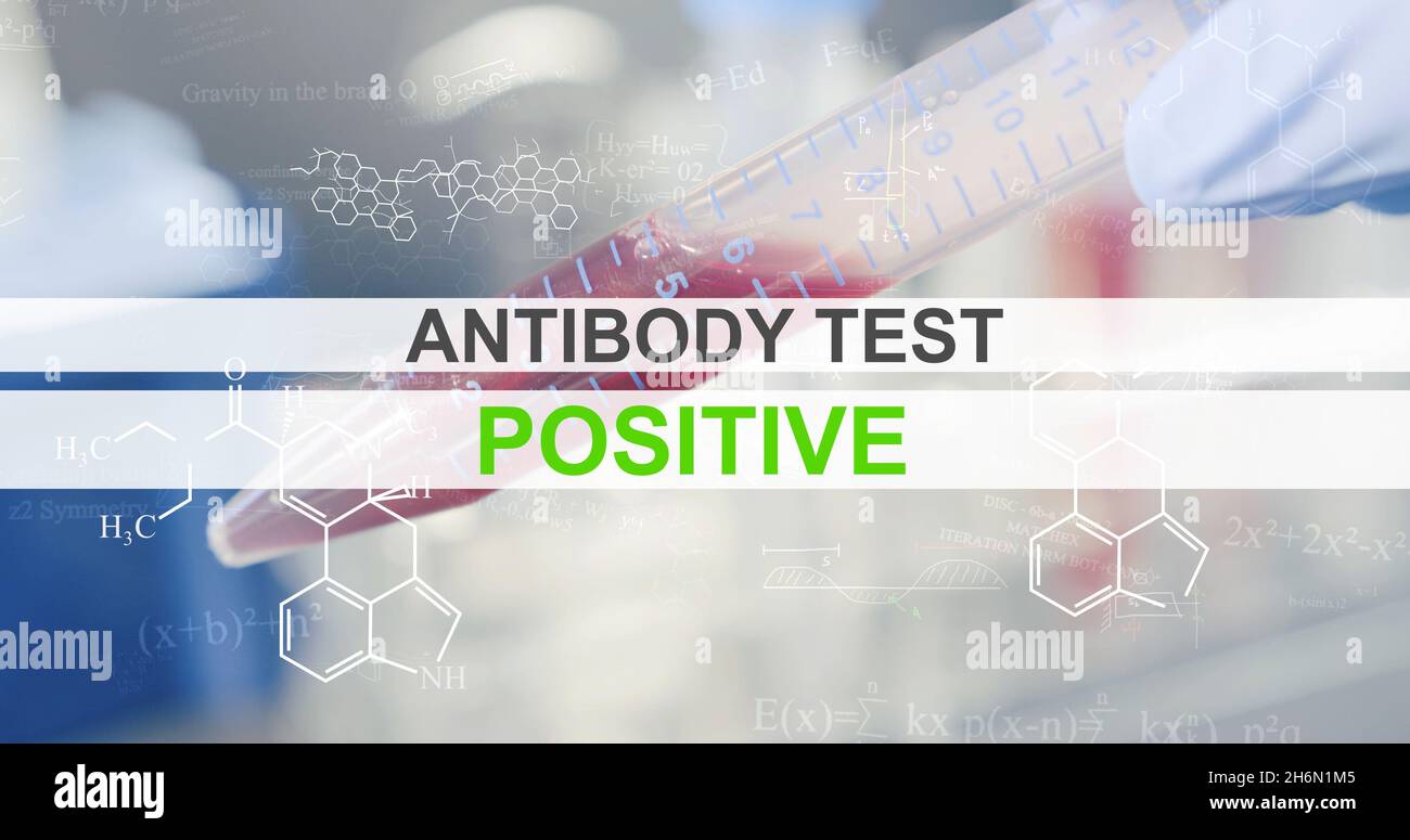Positive poster hi-res stock photography and images - Alamy