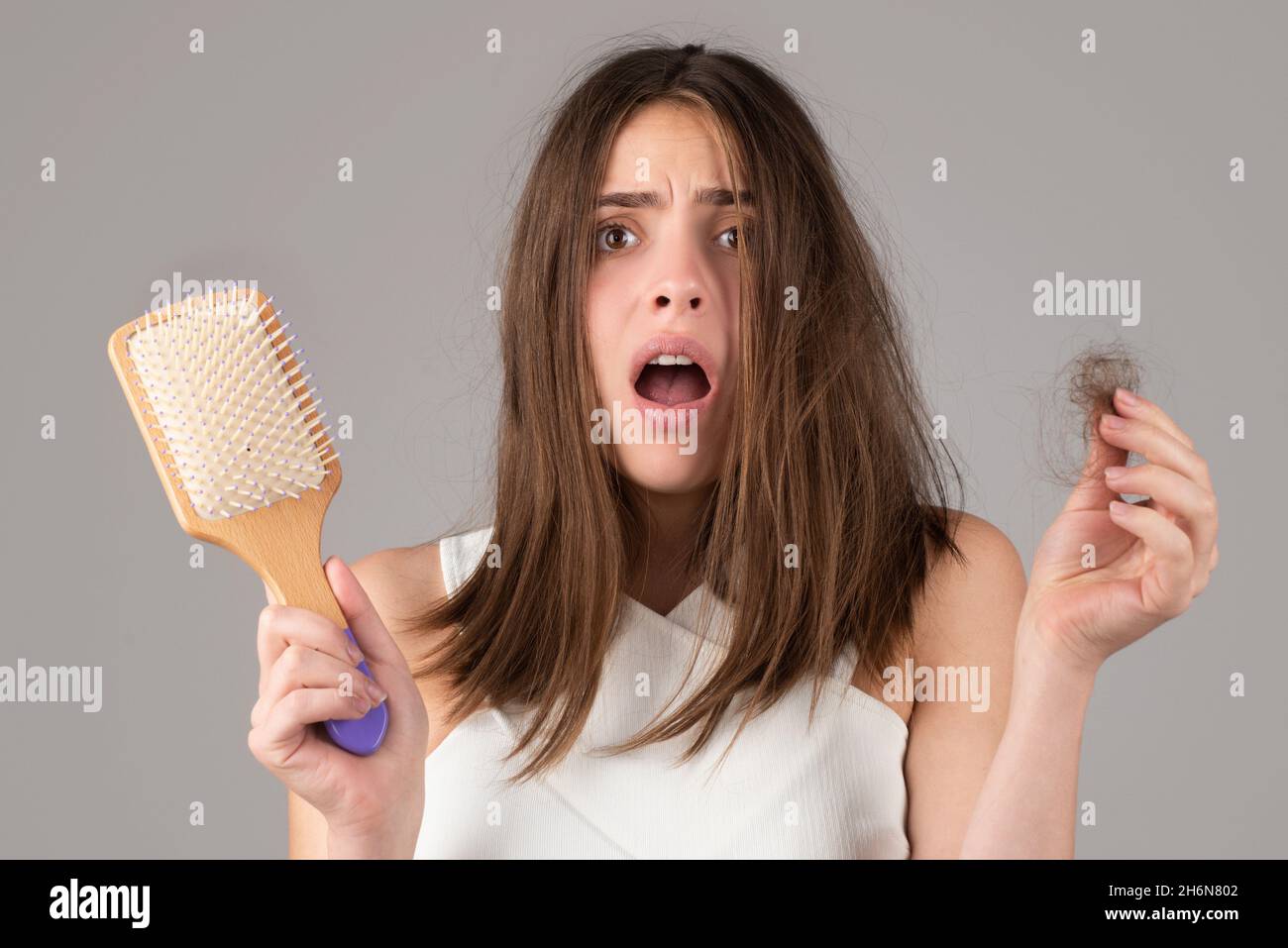Hair loss. Woman is upset of hair loss. Portrait of sad girl with ...