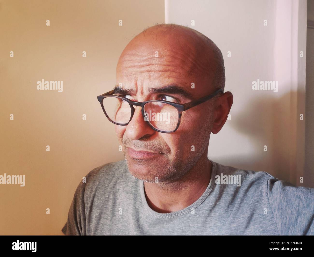 Portrait of a Hispanic bald male with sunglasses and a strange facial ...