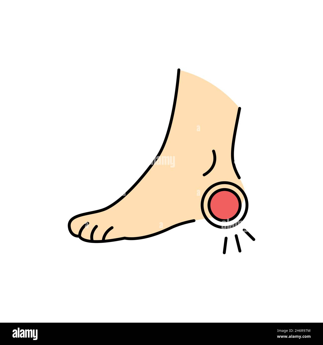 Heel spur Stock Vector Images - Alamy