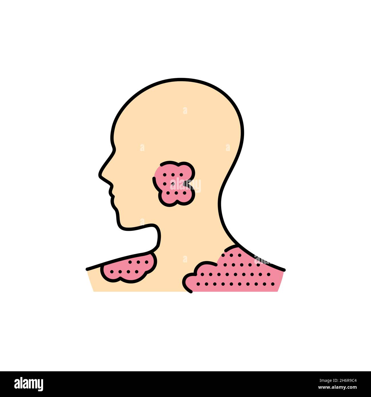 Skin itch color line icon. Human diseases. Pictogram for web page ...
