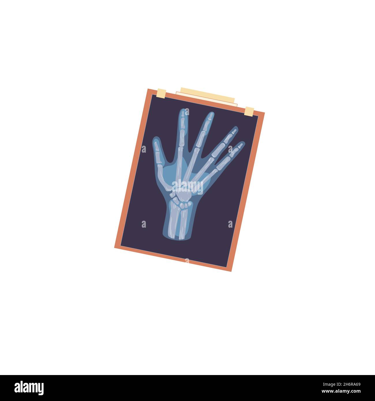Flat cartoon x-ray photo of person hand,human skeleton anatomy ...