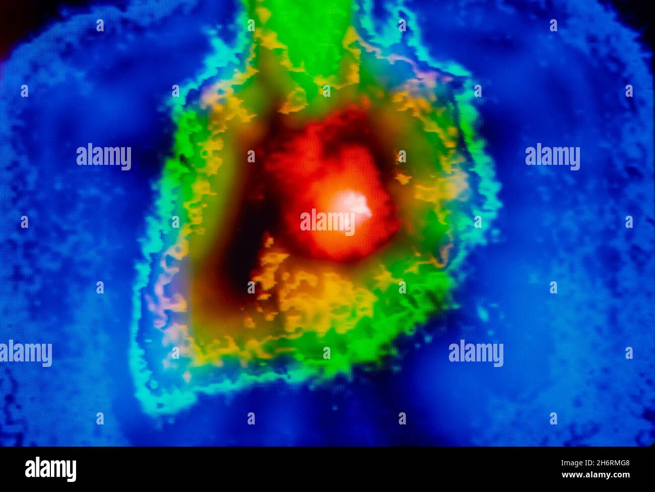 computer cancer abstract in body Stock Photo - Alamy