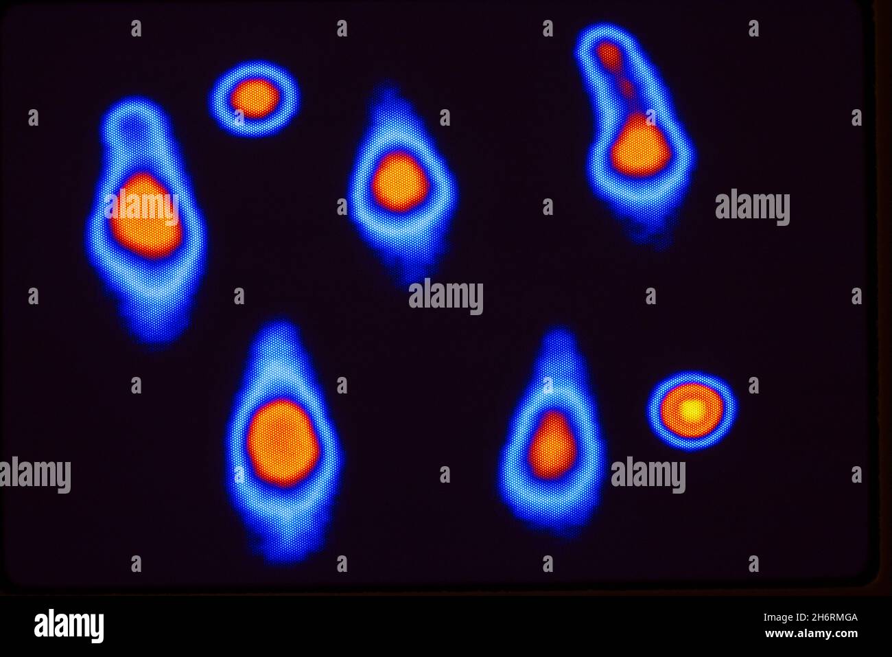 computer cancer abstract in body Stock Photo - Alamy