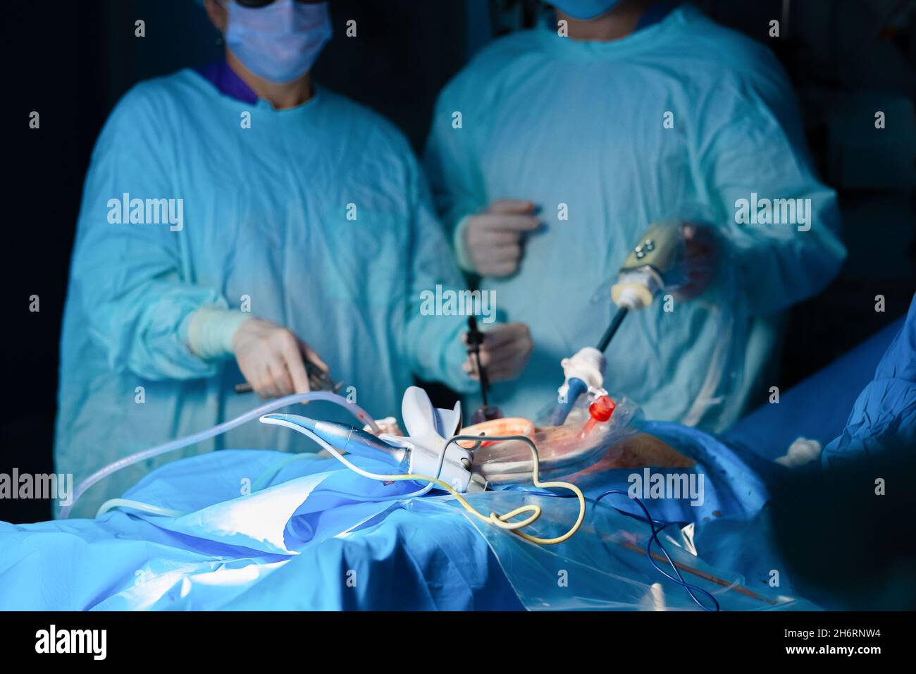 Selective focus on a laparoscopic manipulator lying on the patient's ...