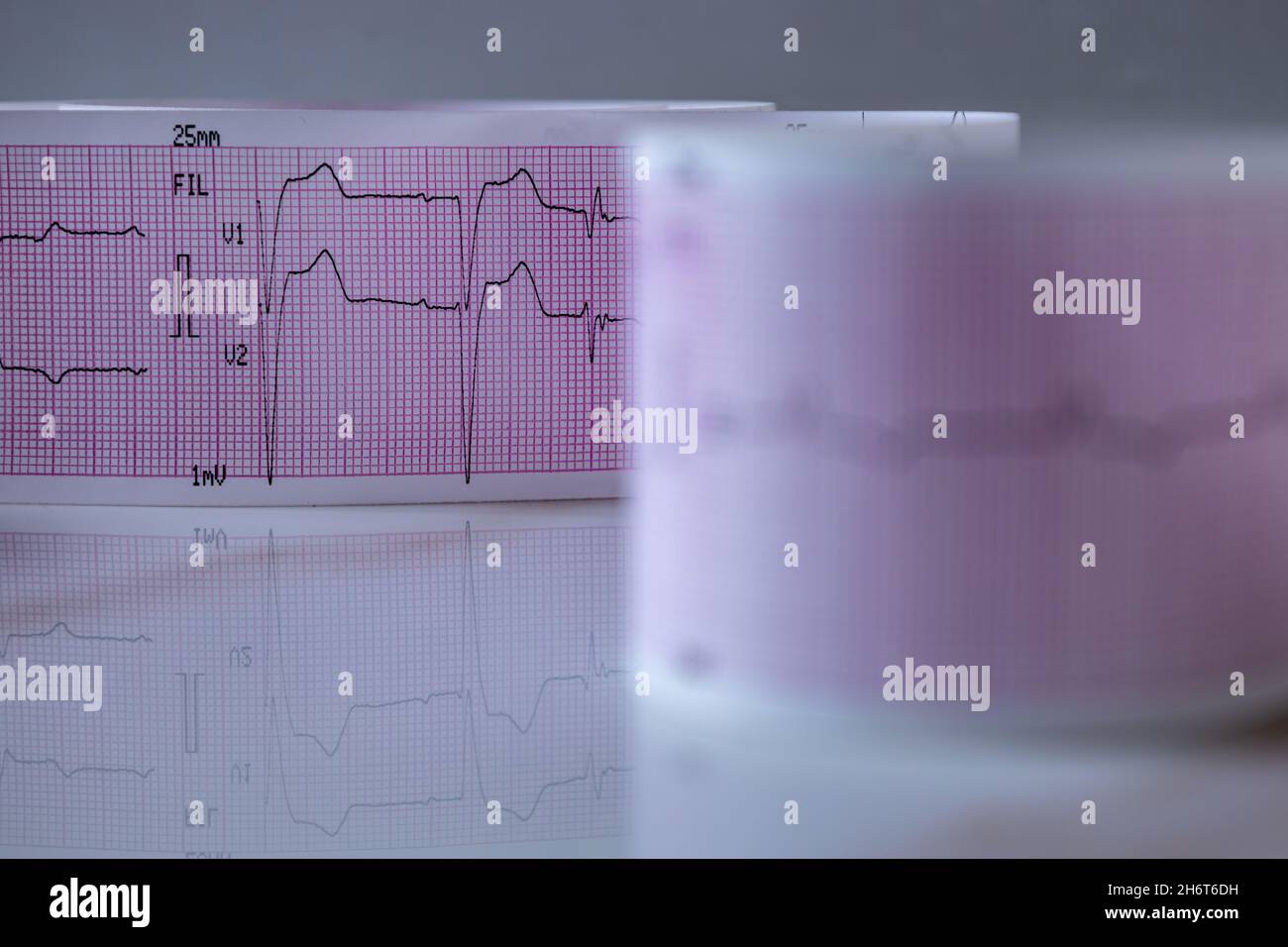 Ekg strip hi-res stock photography and images - Alamy