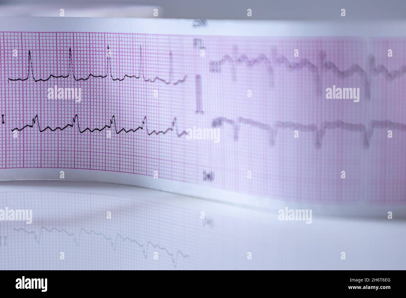 Electrocardiogram graph ekg heart rhythm hi-res stock photography and ...