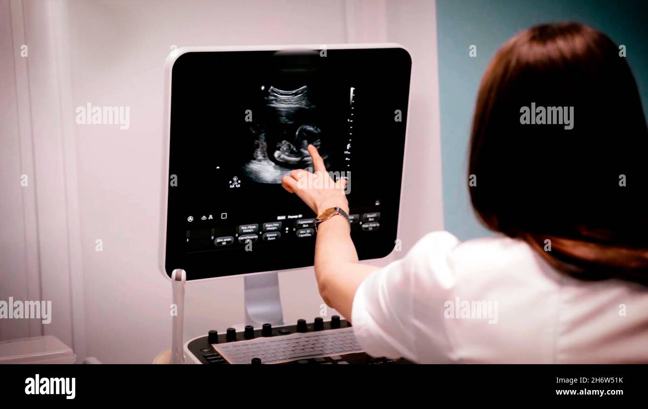 Doctor nurse looking computer monitor hi-res stock photography and ...