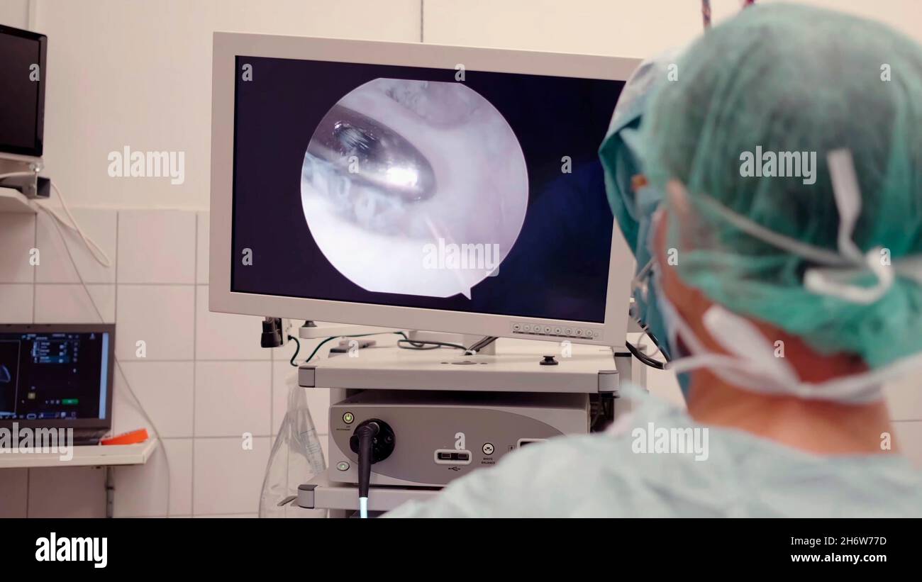 close-up of a doctor or surgeon observing the operation on a monitor in ...
