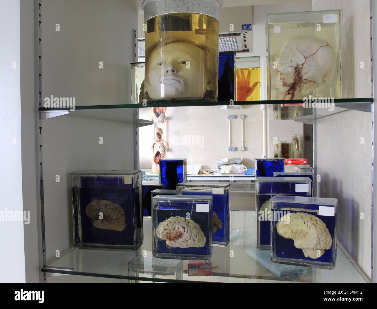 Lisboa, Portugal. 18th Nov, 2021. (INT) Embalmed head of the first ...