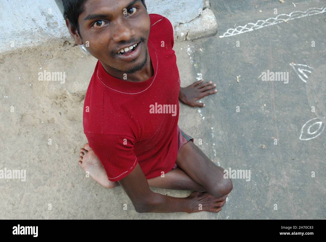 Differently able person hi-res stock photography and images - Alamy