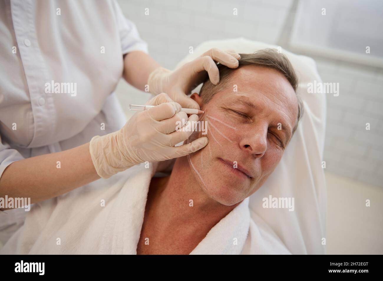 Cosmetologist drawing guidelines for injection of cosmetic product with ...