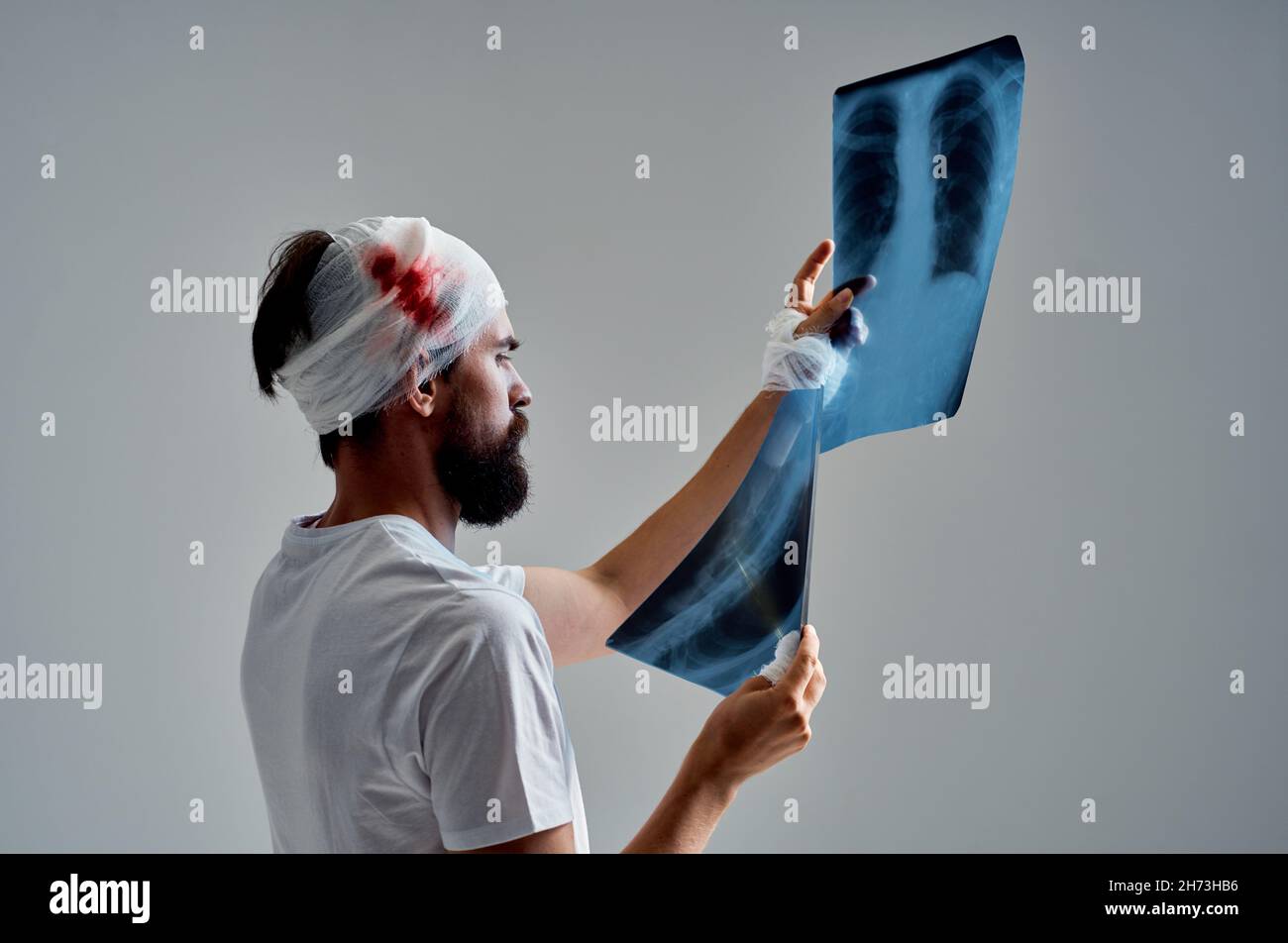 bearded man head injury radiology isolated background Stock Photo - Alamy