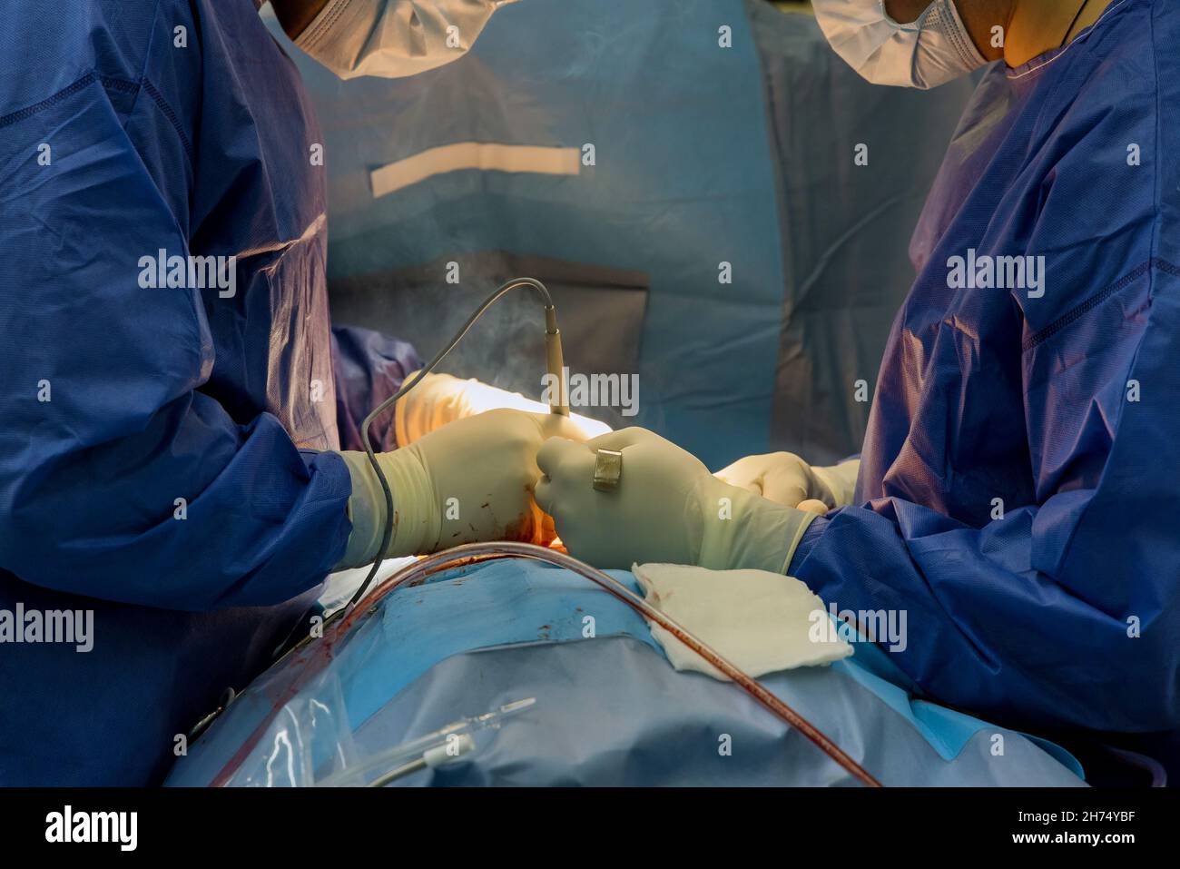 Process surgery of operation using medical equipment in operating room ...