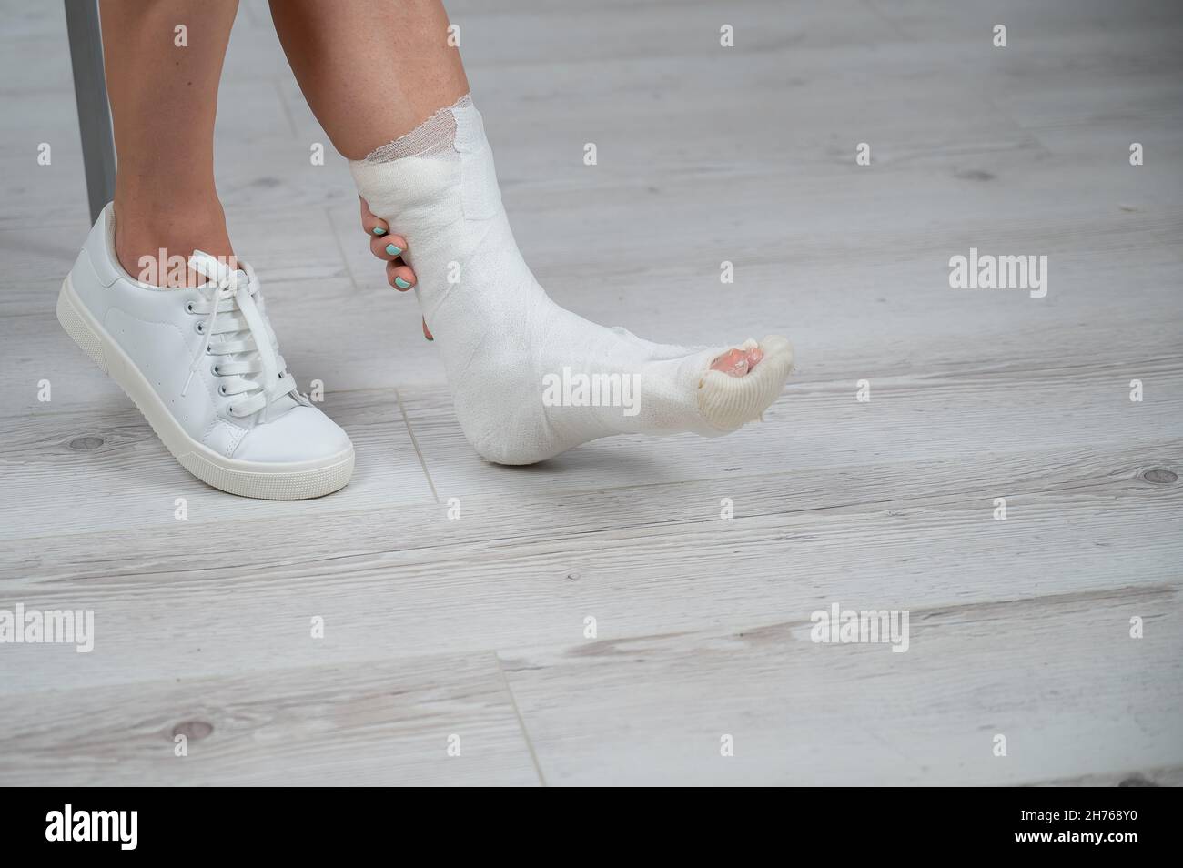 Plaster leg cast legs hi-res stock photography and images - Alamy