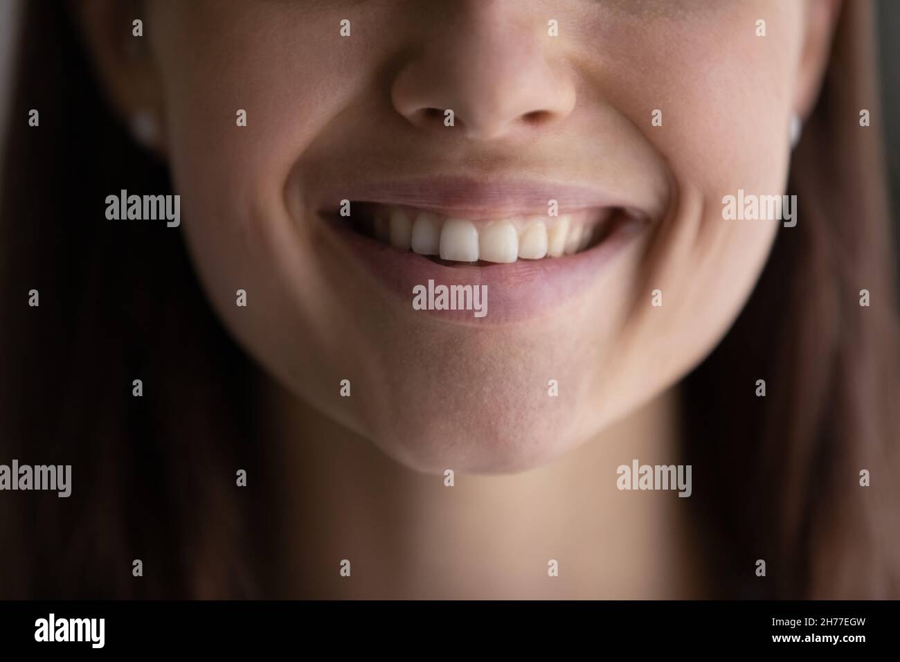 Straight teeth hi-res stock photography and images - Alamy