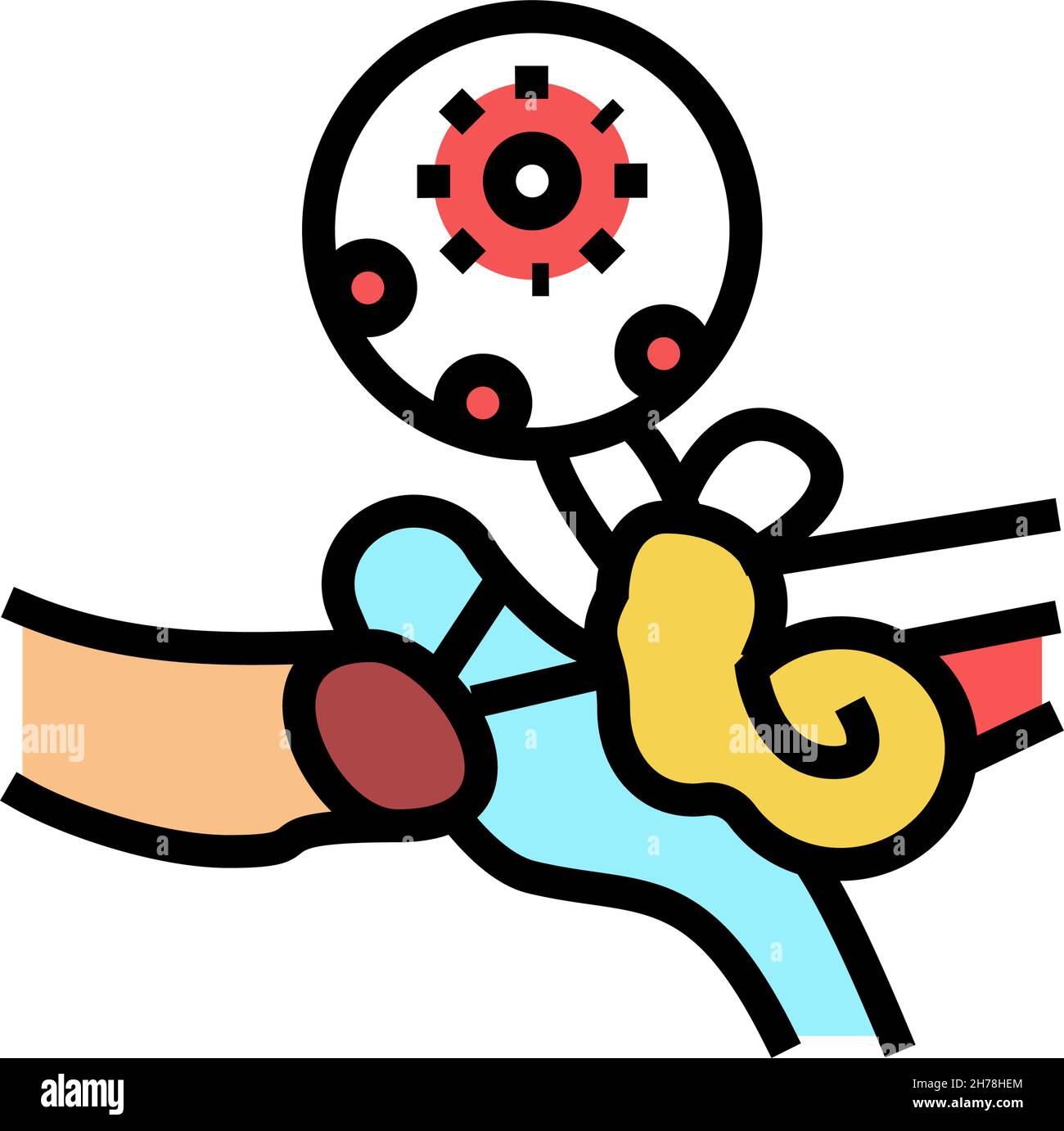 cholesteatoma health problem color icon vector illustration Stock ... cholesteatoma health problem color icon vector illustration Stock ...