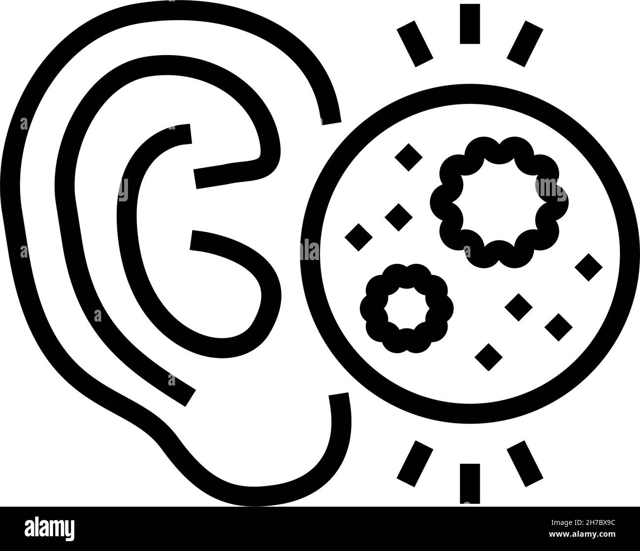 Dysphagia vector Black and White Stock Photos & Images - Alamy