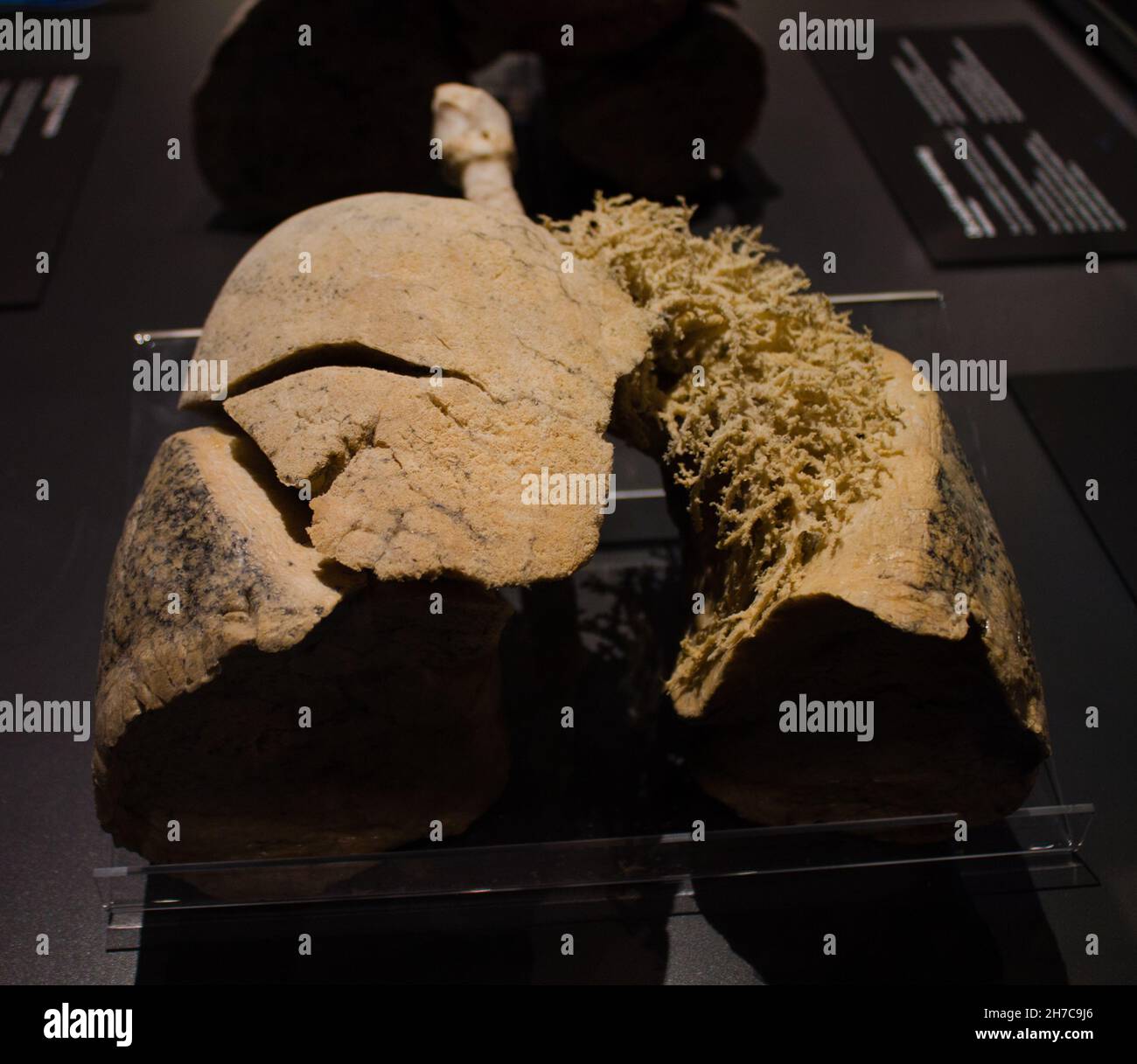 Closeup shot of human artifical lungs skeleton in the museum Stock ...