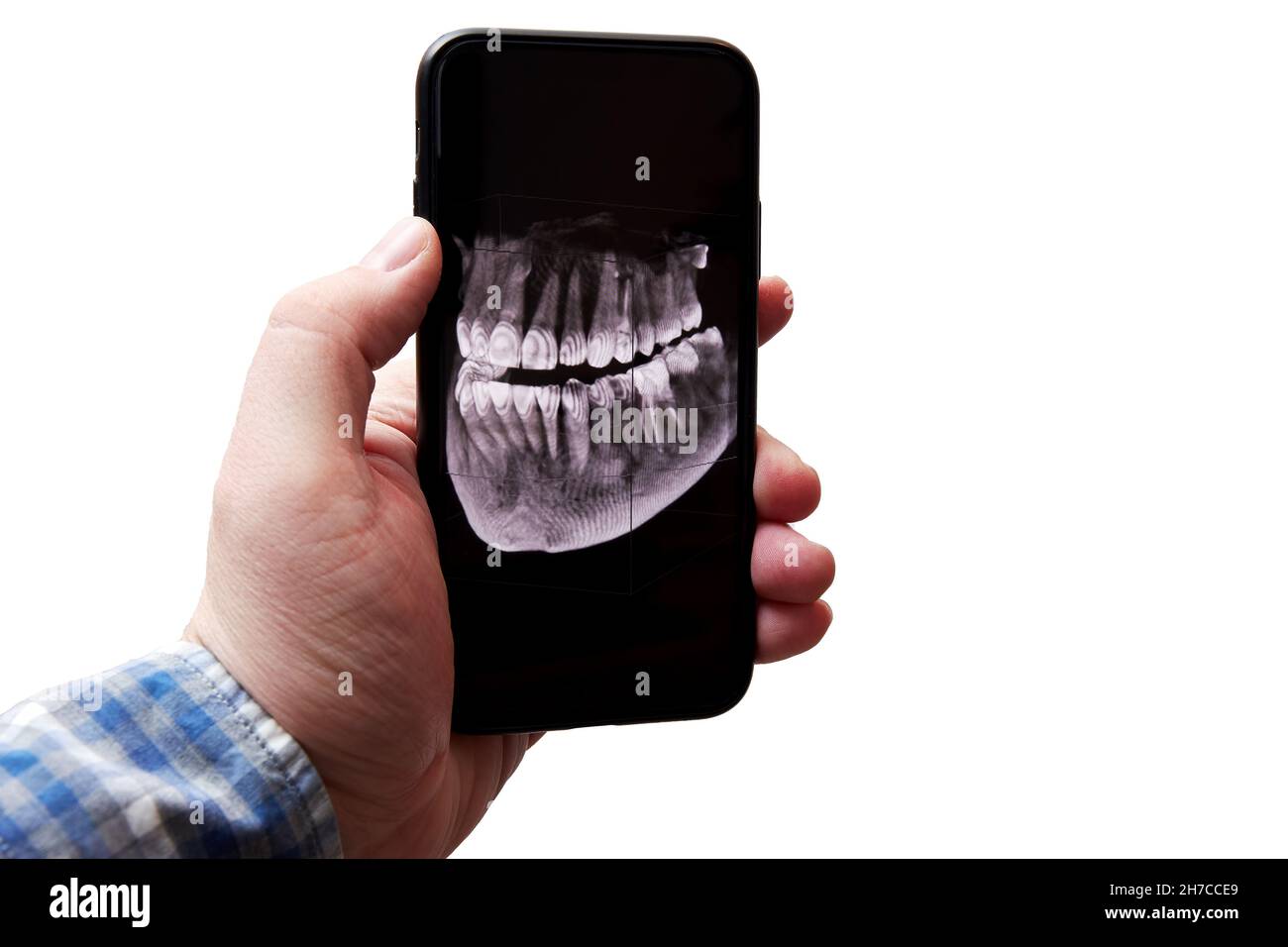 Man's hand holding a mobile phone with an x-ray image of his jaw and ...