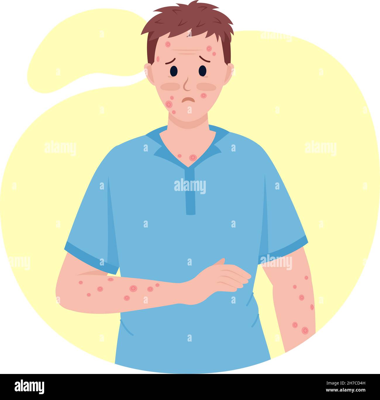 Man with skin rash semi flat color vector character Stock Vector Image ...