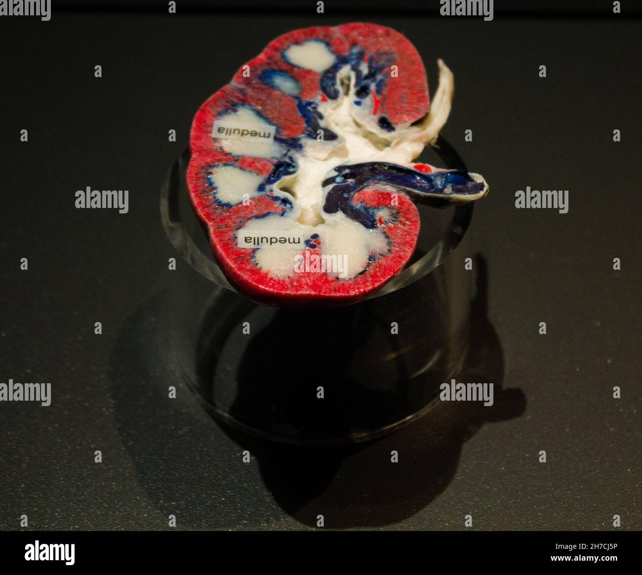 Closeup shot of a kidney artificial structure with mentioning medulla ...