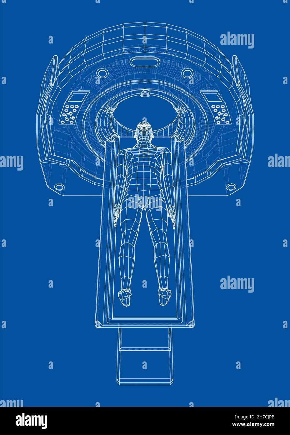 MRI machine scanning patient inside Stock Photo - Alamy