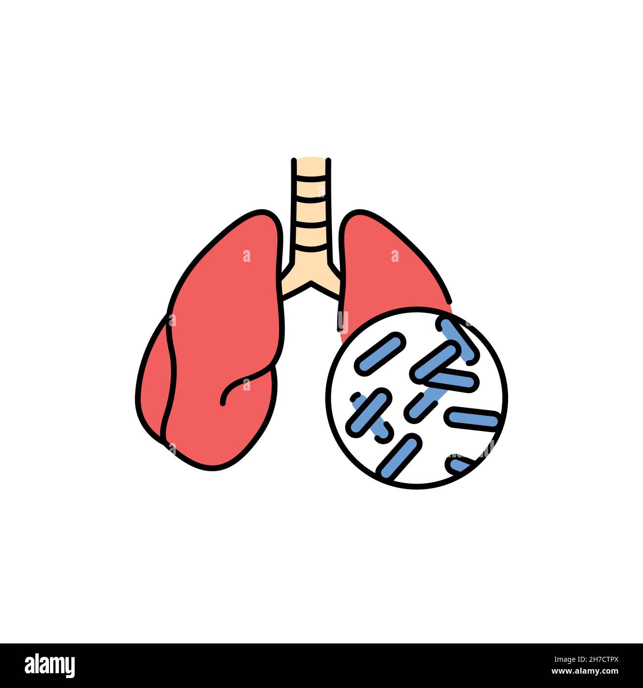 Tuberculosis drawing Cut Out Stock Images & Pictures - Alamy