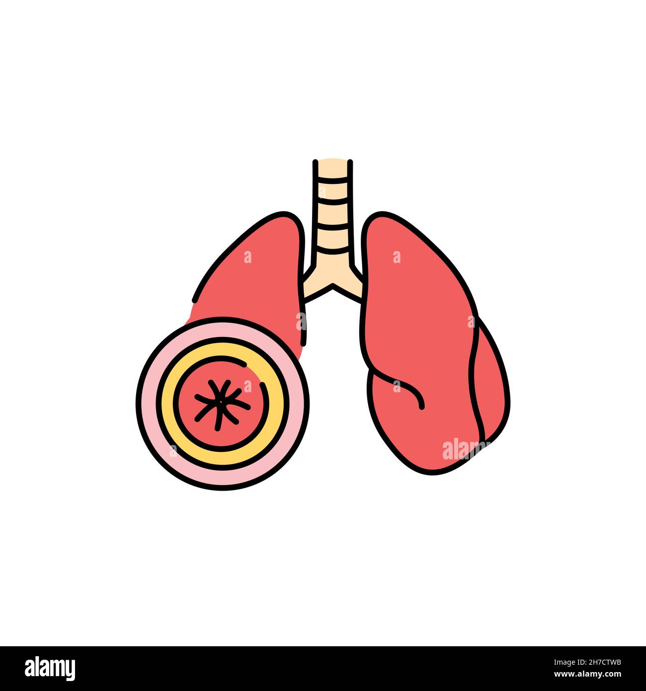 Bronchitis chronic anatomy Stock Vector Images - Alamy