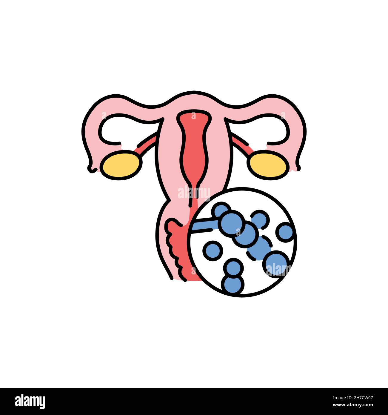 Ascaris worms hi-res stock photography and images - Alamy