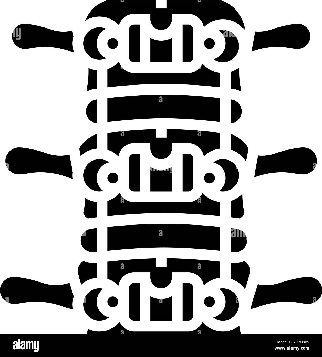 Spinal fusion Black and White Stock Photos & Images - Alamy