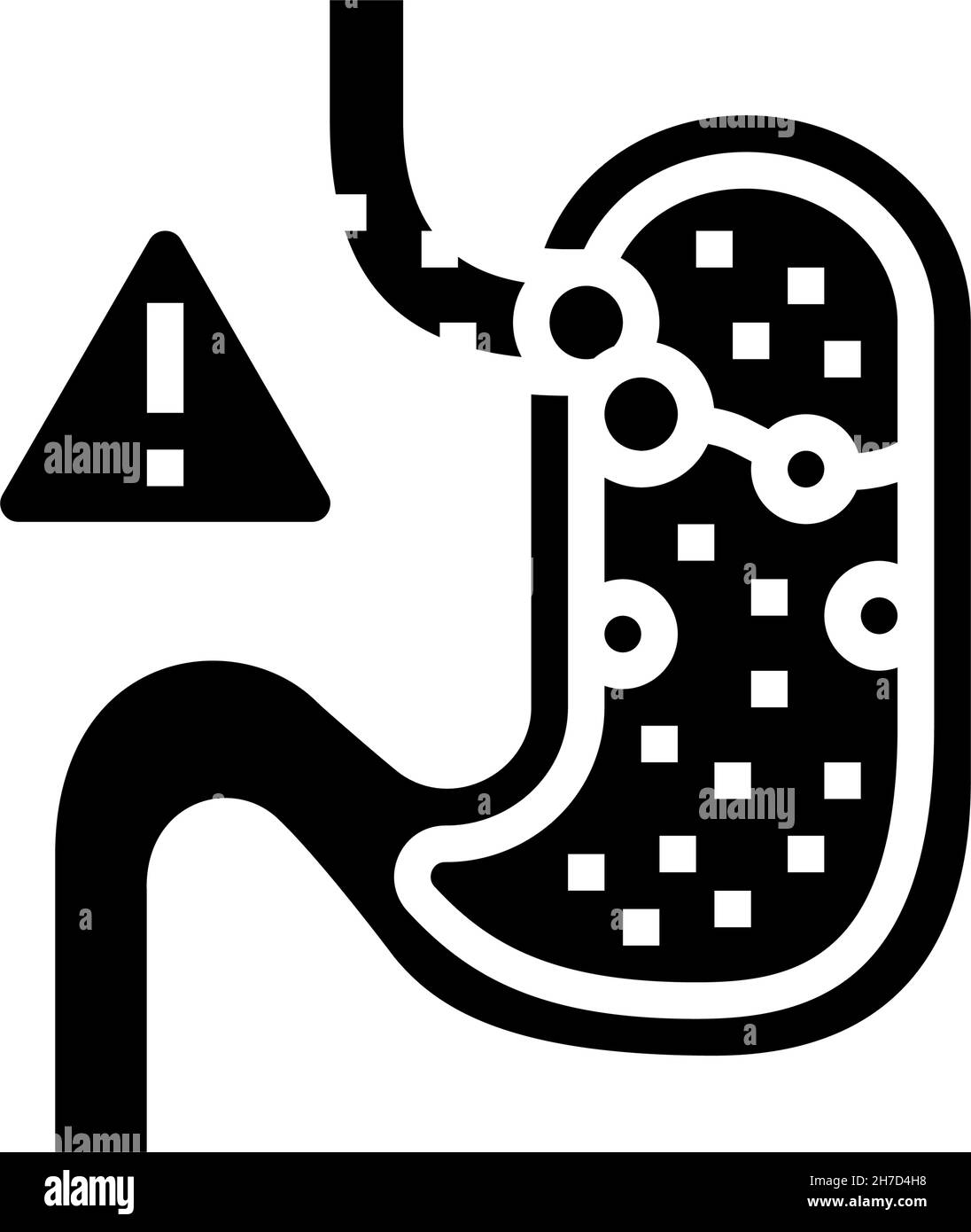 Gastric reconstruction hi-res stock photography and images - Alamy