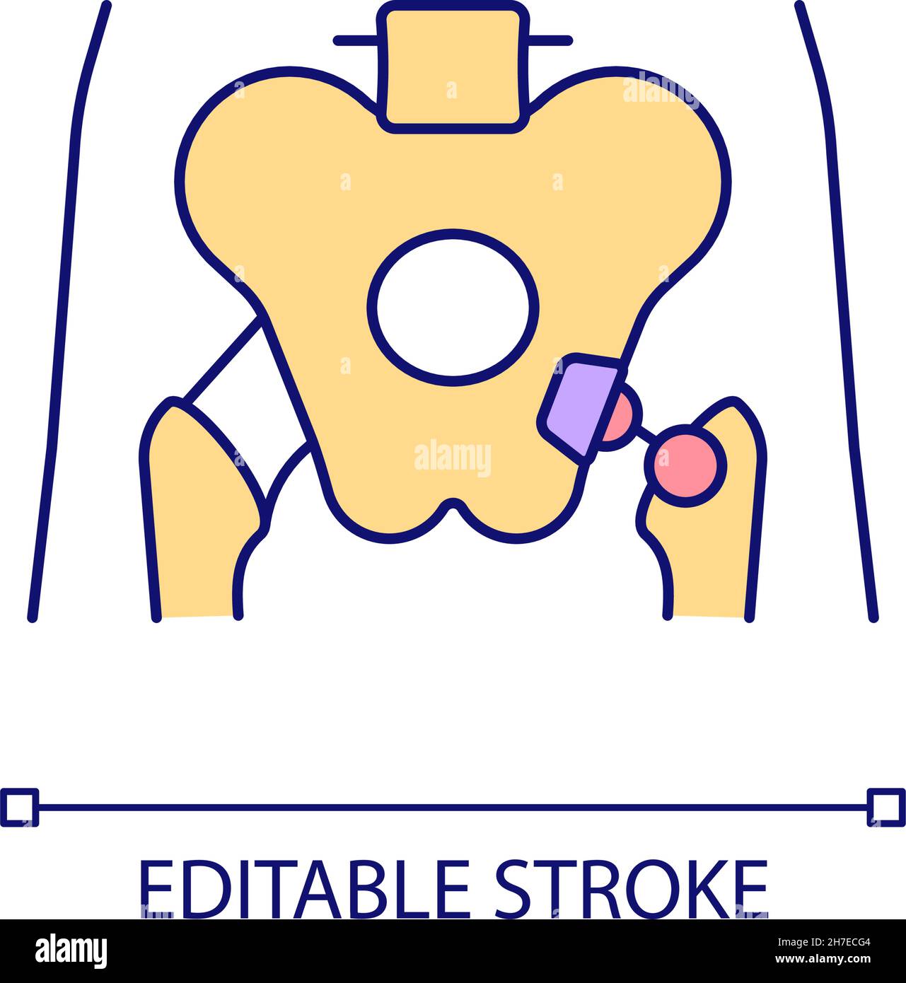 Hip replacement RGB color icon Stock Vector Image & Art - Alamy