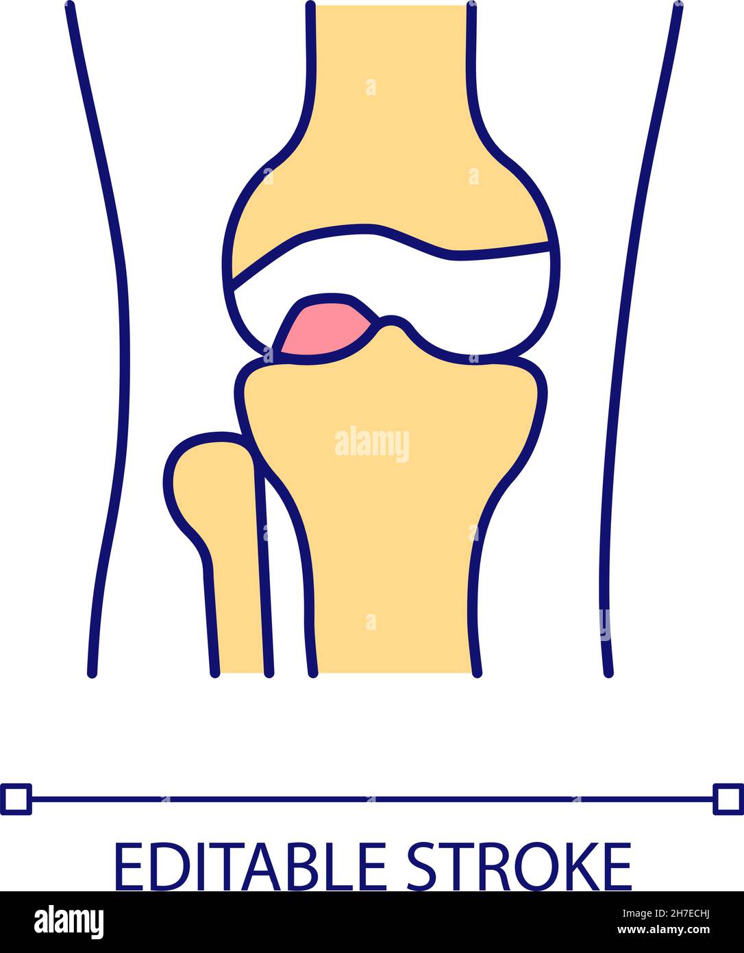 Knee joint RGB color icon Stock Vector Image & Art - Alamy